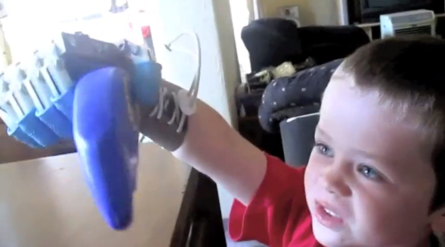 Meet the tinkerer-turned-prosthetic pioneer who 3D printed a working ...