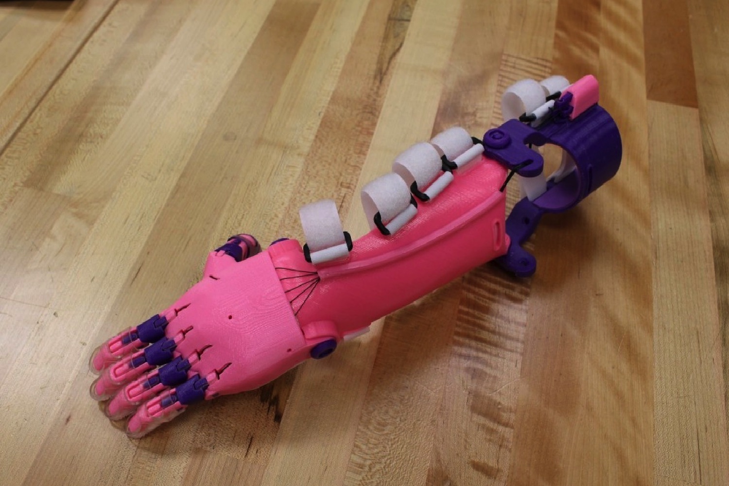 5-year-old girl receives a new hand thanks to 3D printing | Digital Trends